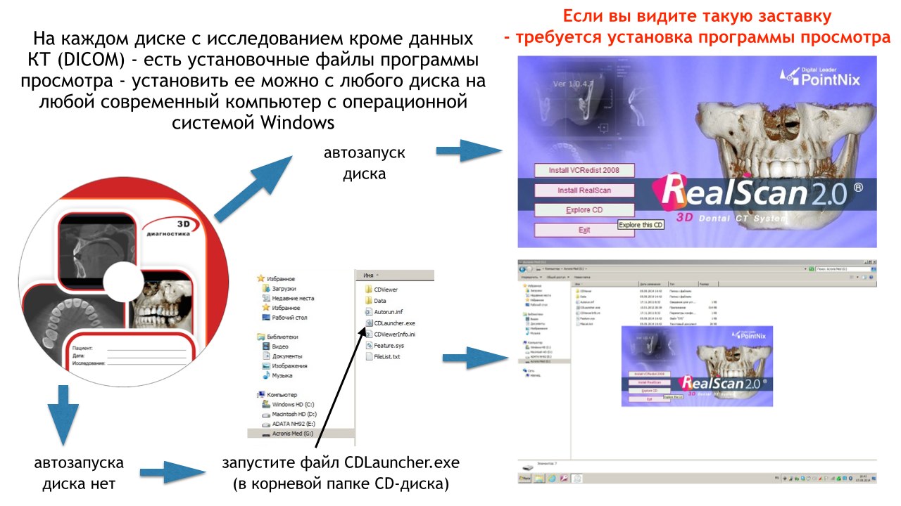 Установка программы просмотра КЛКТ RealScan CDViewer с диска