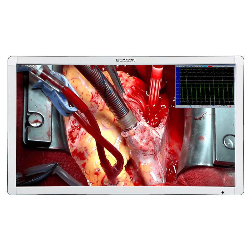 Surgical Monitor S3221P - Beacon