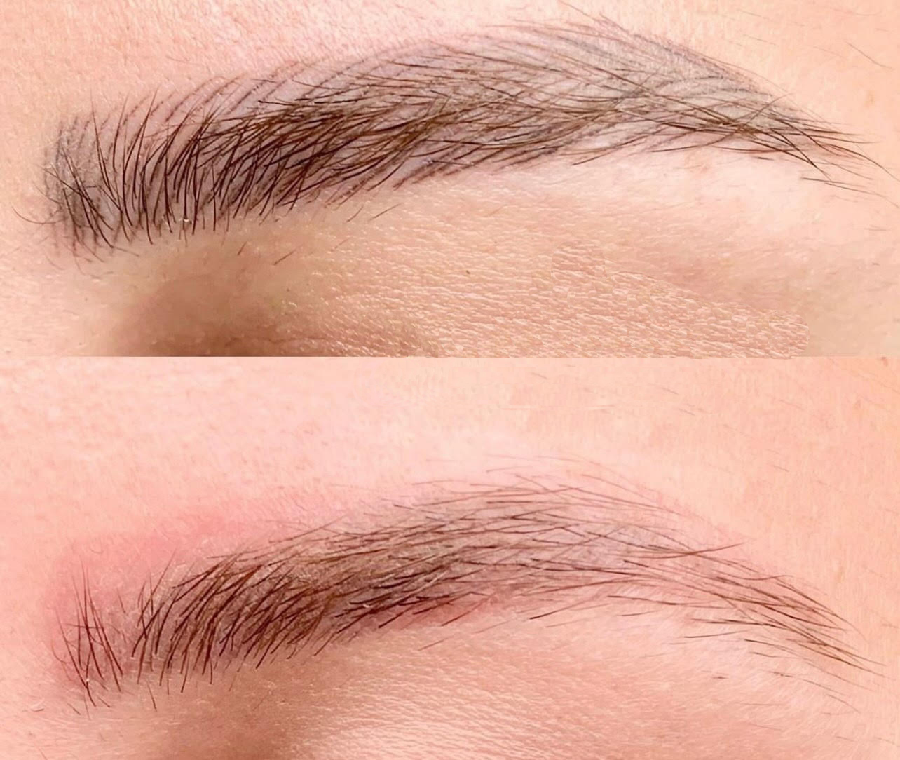 Old PMU/Microblading Removal
