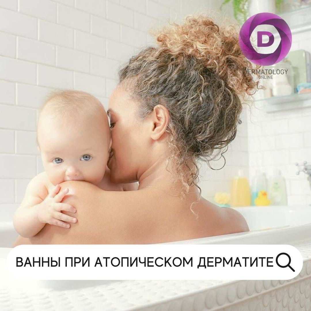 Какие ванны принимать при атопическом дерматите