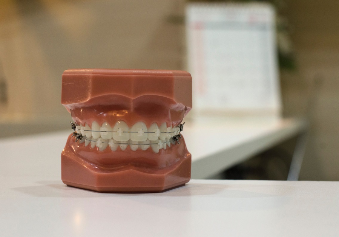 Amalgam filling