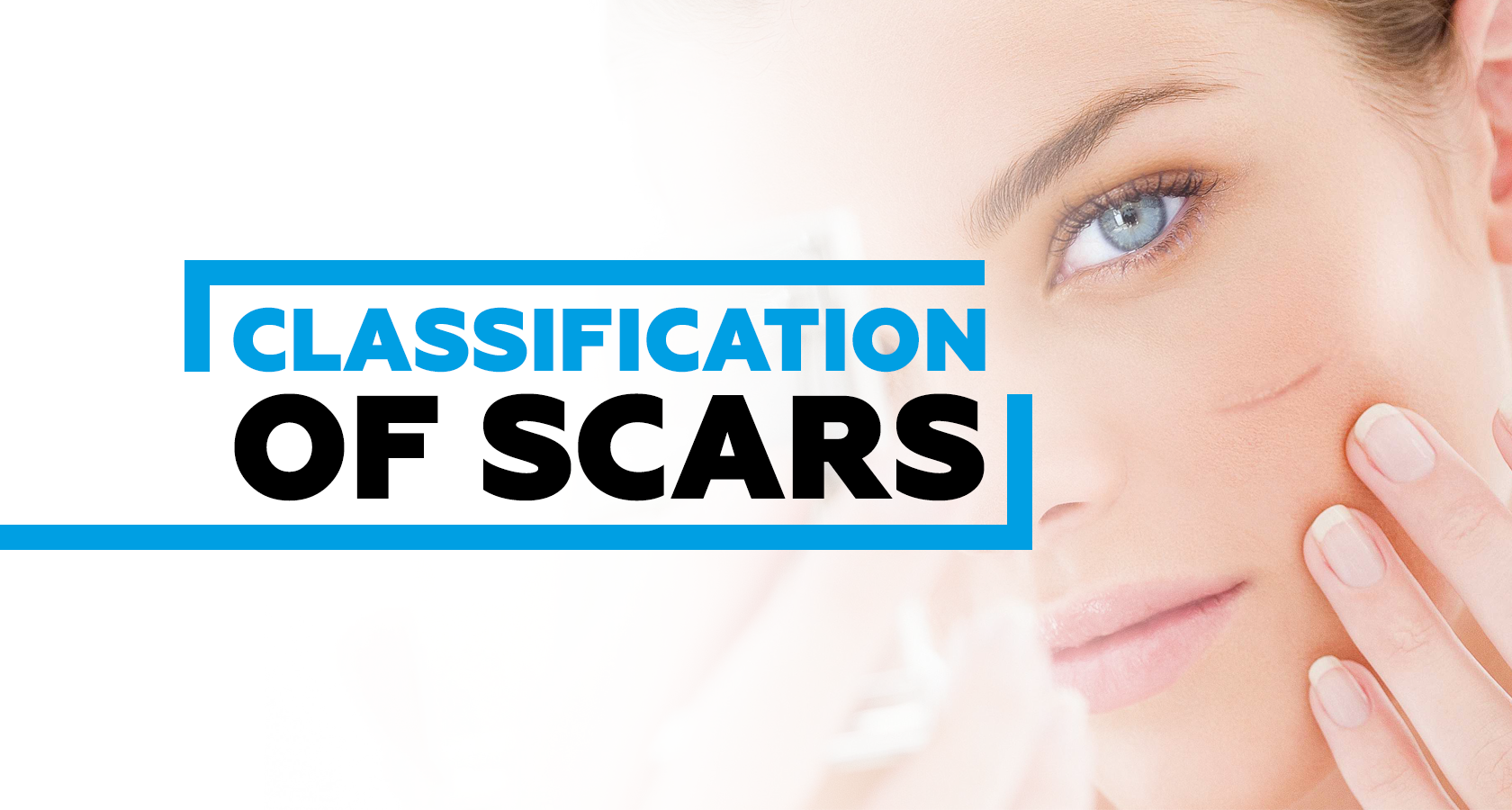 Classification of scars