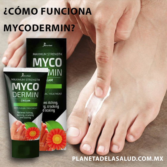 MycoDermin crema de tratamiento de hongos. Dónde comprar en Guatemala?