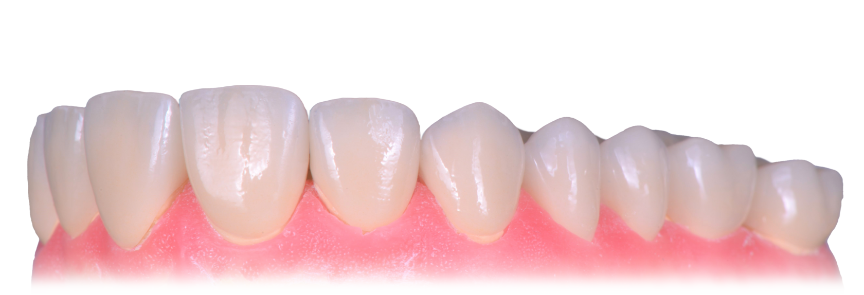 Рикардо Фоменко - «VERTIPREP F.D.CONCEPT Реставрационно-пародонтологический курс о ...