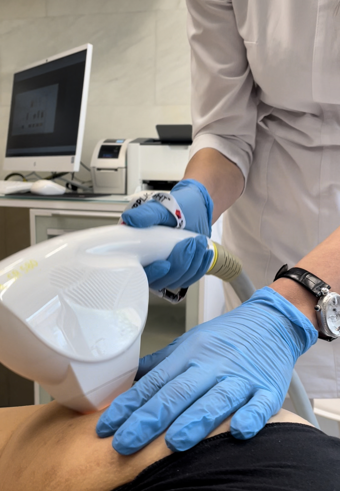 Фотоомоложение IPL Sharplight в Санкт-Петербурге | Клиника М32