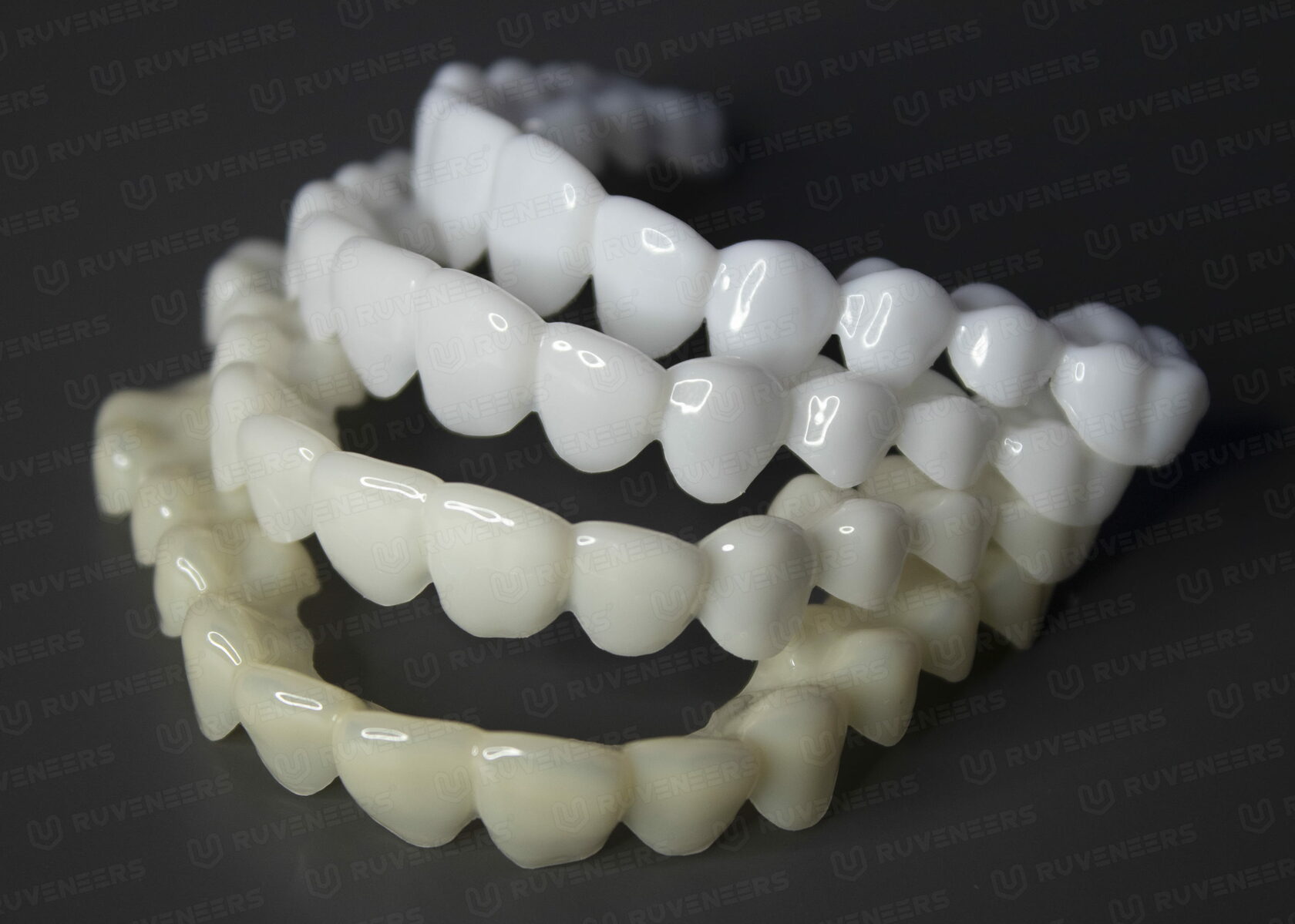 Individual removable veneers | RUVENEERS