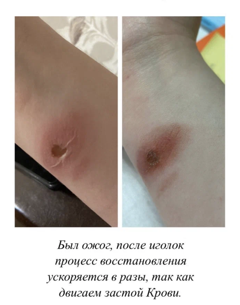 Практическая акупунктура