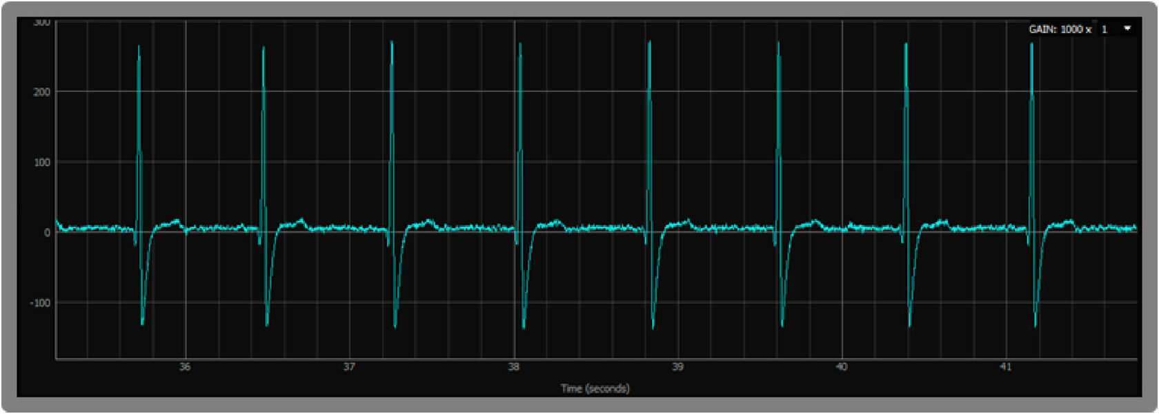 Overview of the EMG/ECG signal registration module MYO v1.4