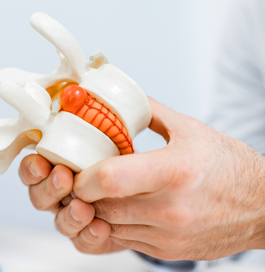 Herniated Disc Resorption Without Surgery — 94% Success Rate