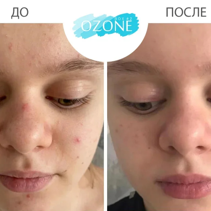 Магазин Озоновой Косметики Insta