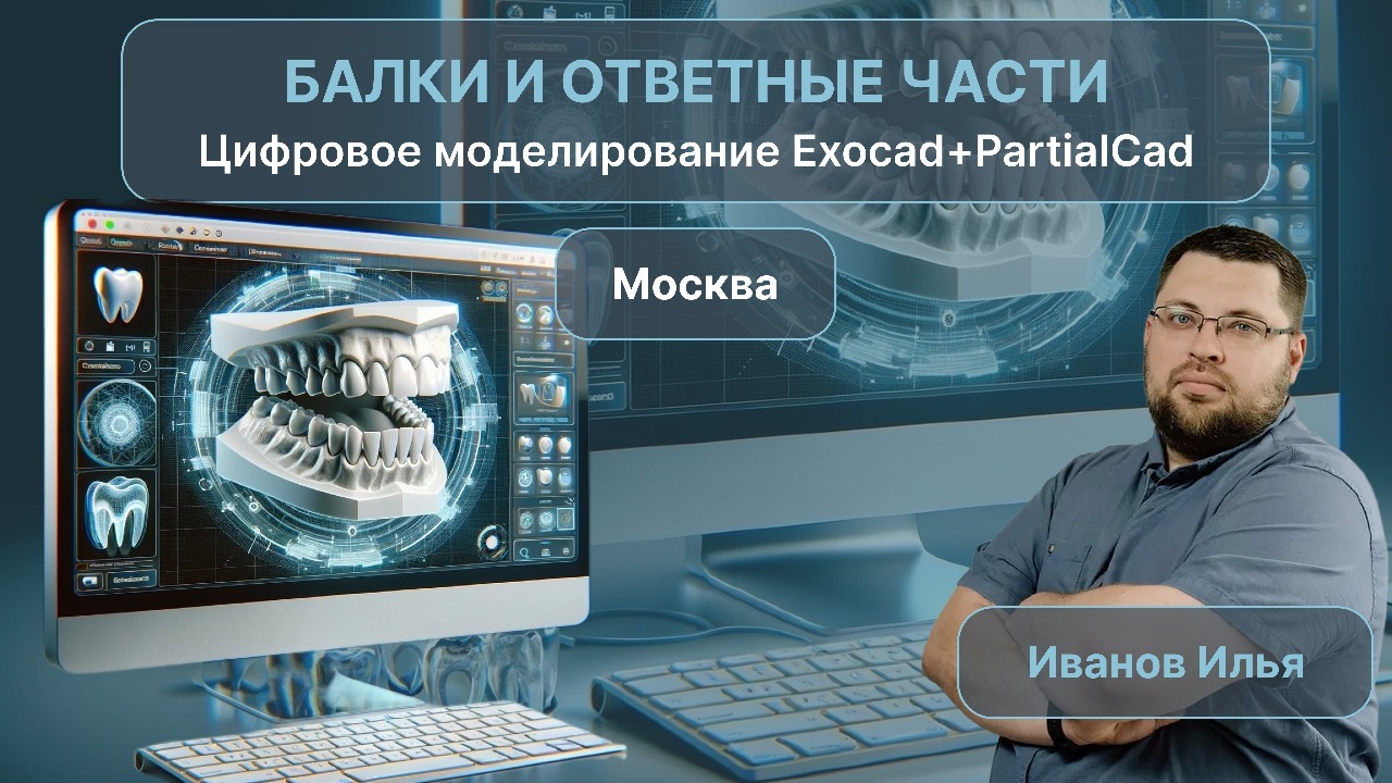 БАЛКИ И ОТВЕТНЫЕ ЧАСТИ Цифровое моделирование Exocad+PartialCad