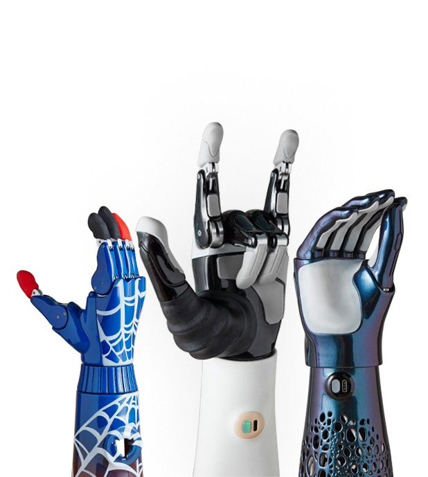 Types of arm prostheses