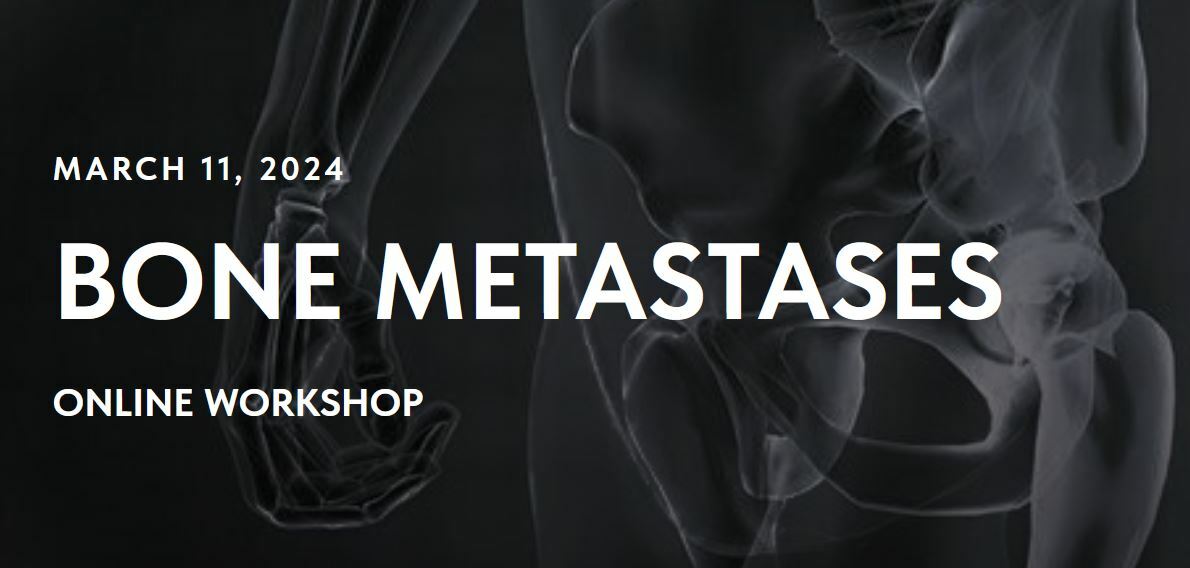 Bone Metastases