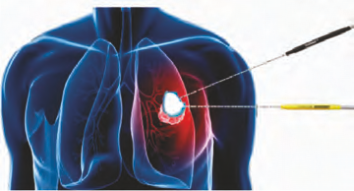 Perfint™ Maxio® | Россия