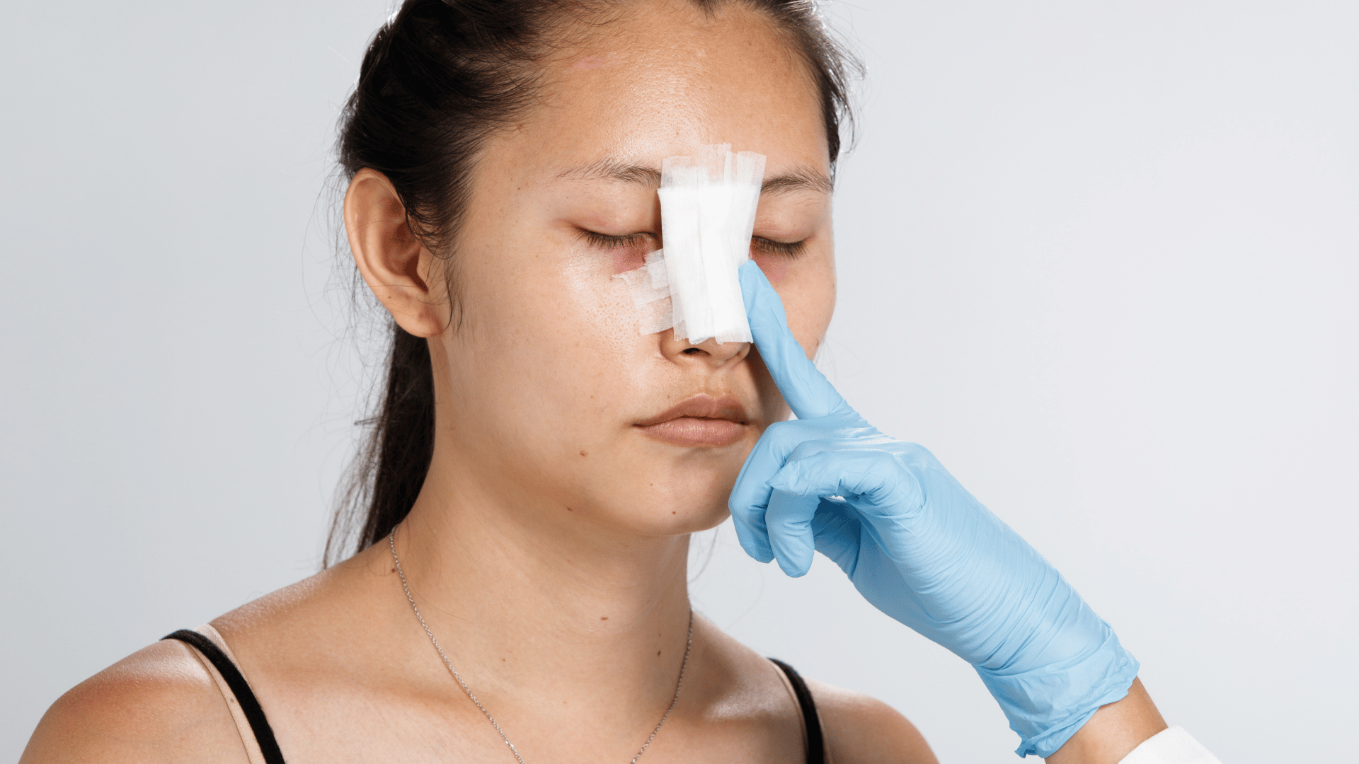 Asian Nose Rhinoplasty: Enhancing Features While Preserving Identity