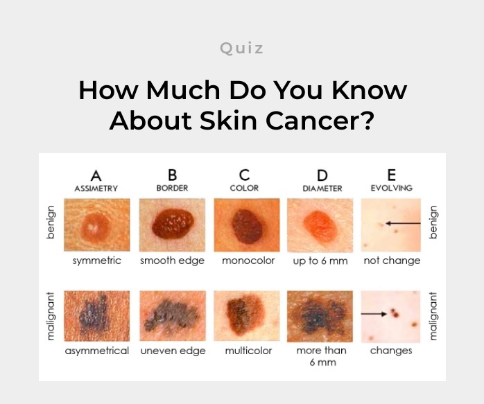 How Much Do You Know About Skin Cancer?
