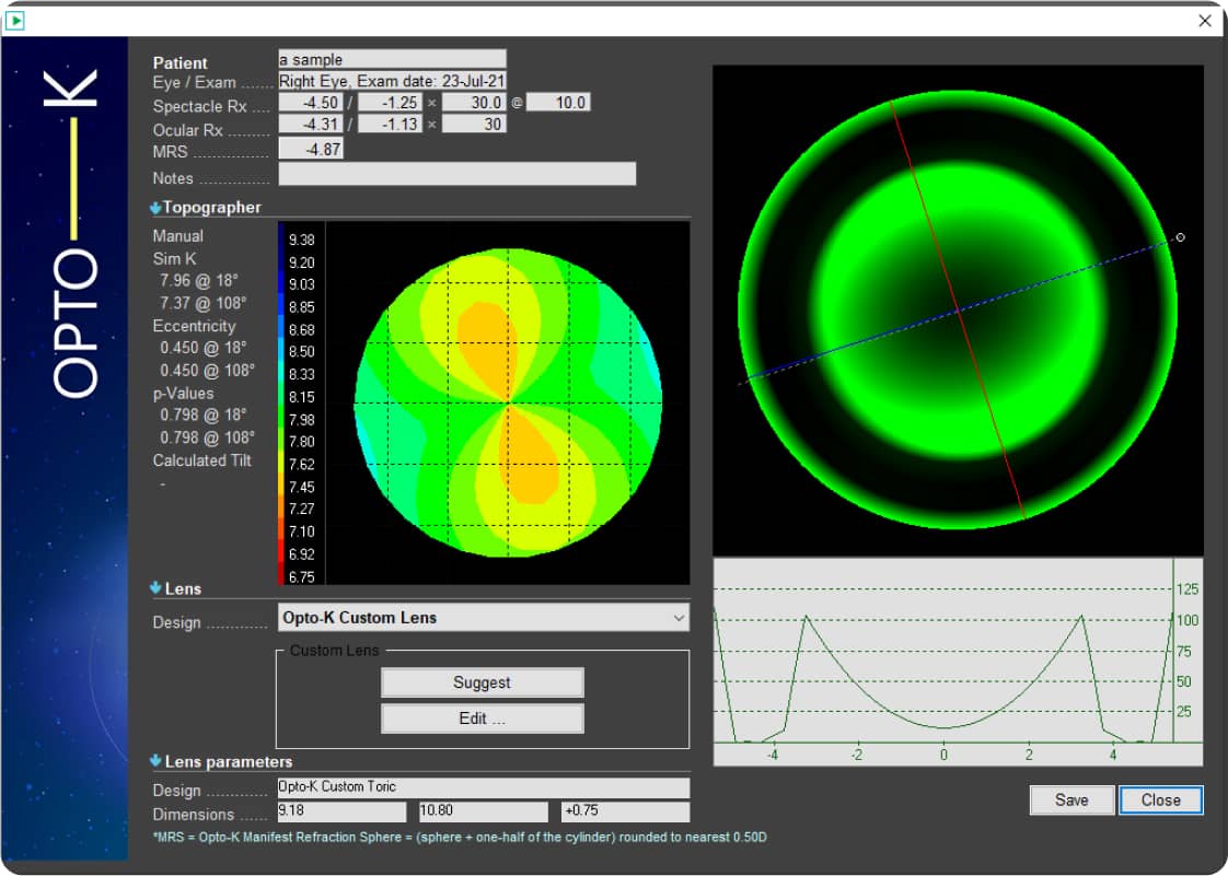 Opto-K lenses | Optosoft
