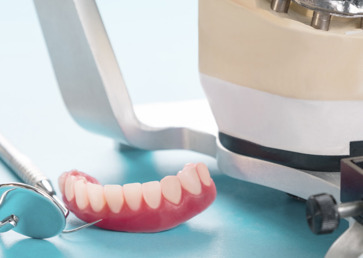 Новая Улыбка за Несколько Дней с All-on-6 Lenmiriot в Москве | Высокая Надежность и Комфорт