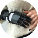 How To Choose a Prosthetic Arm