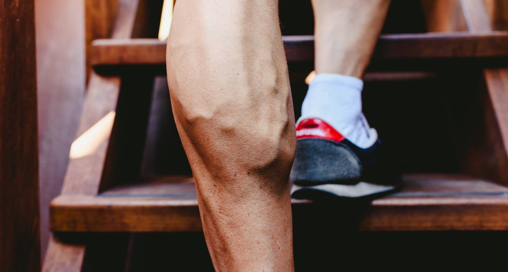 Фитнес при варикозе ног: безопасные тренировки без риска для здоровья ...