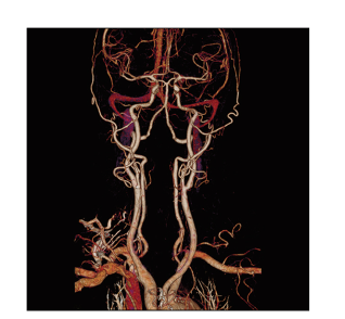 Canon Aquilion ONE GENESIS Edition