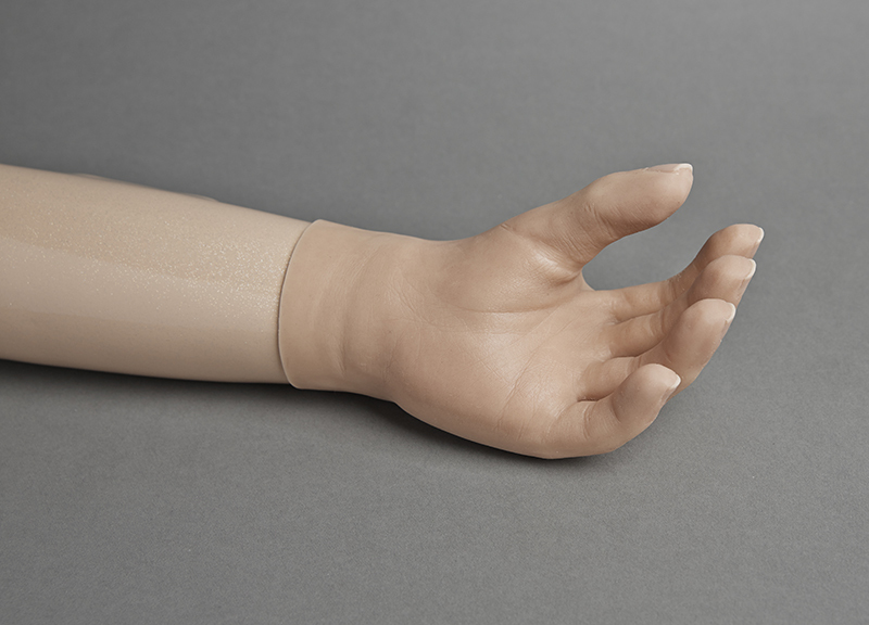 Types of arm prostheses