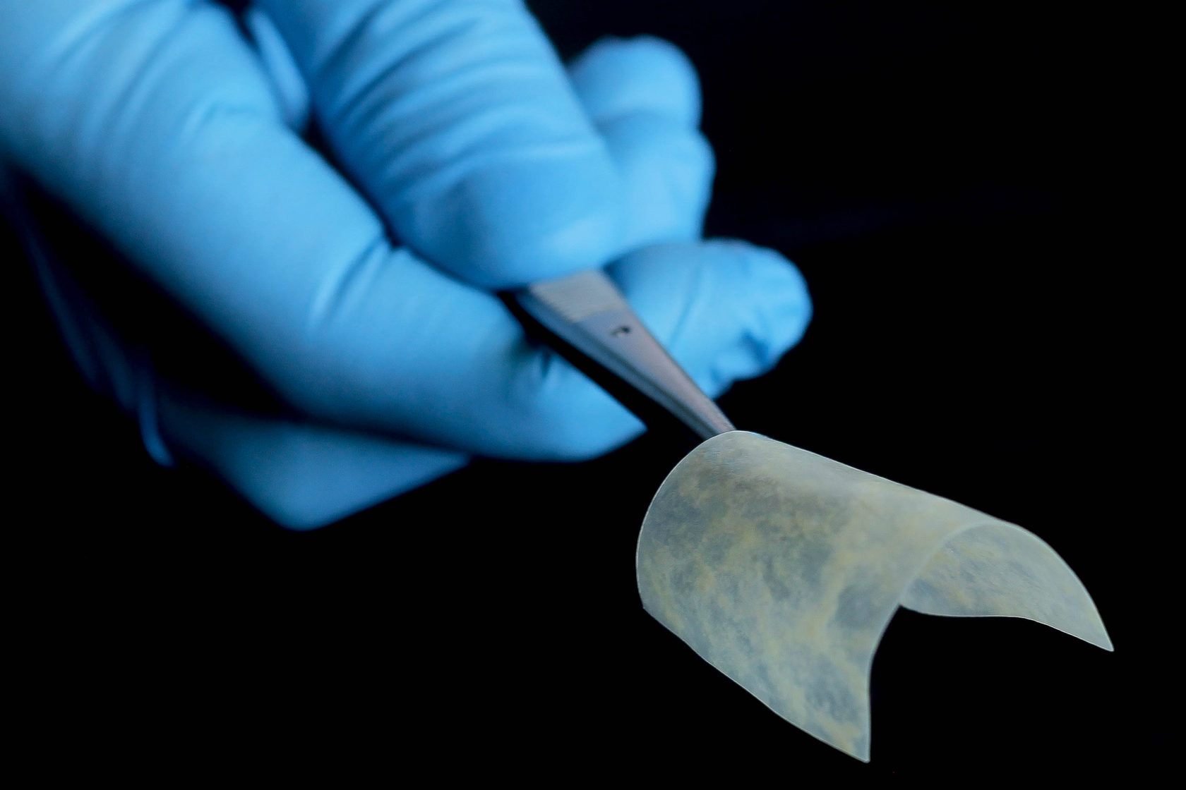 Collagen Scaffold for Cartilage Regeneration