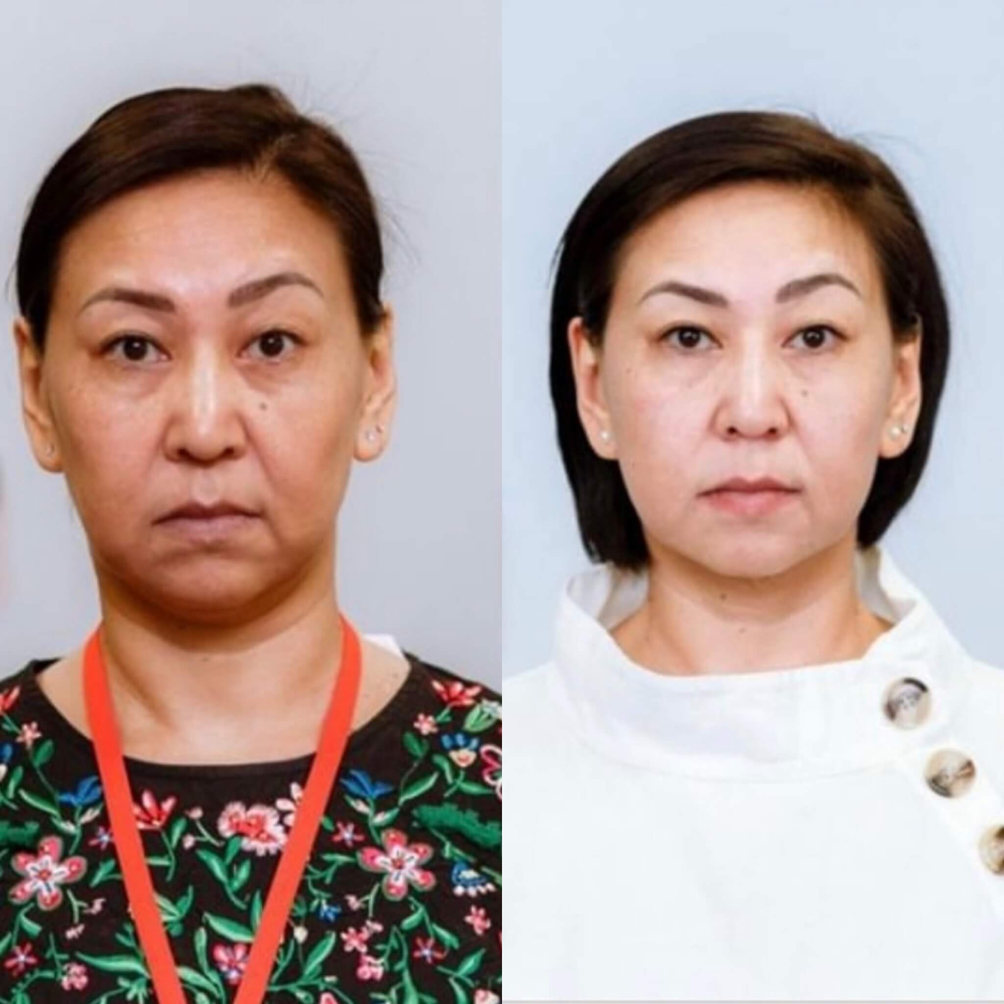 Look 5-10 years younger after taking my Face Fitness courses.