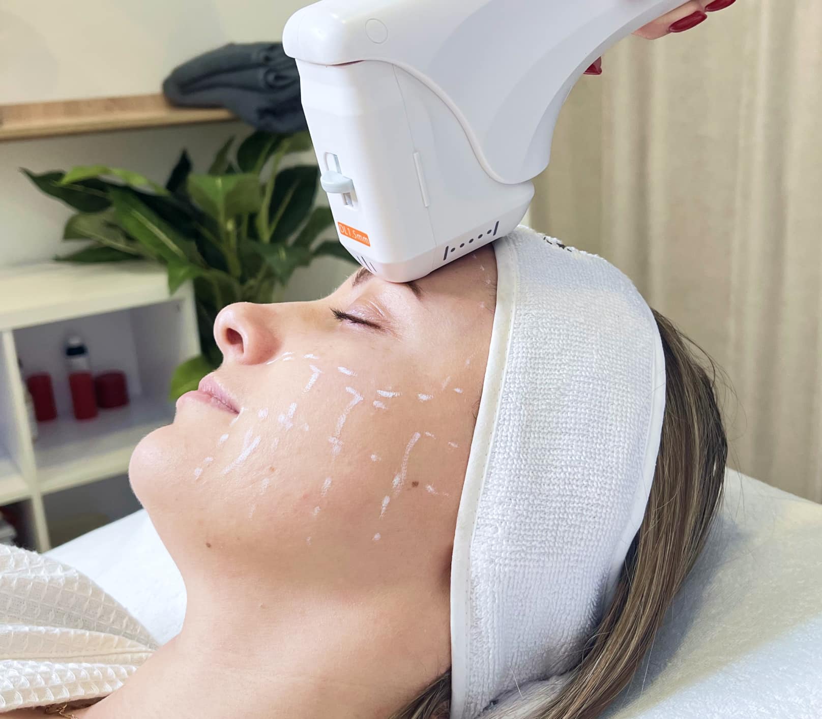 Zemits UltraNexx Lite Lifting Skin Tightening System For Face and Body ...