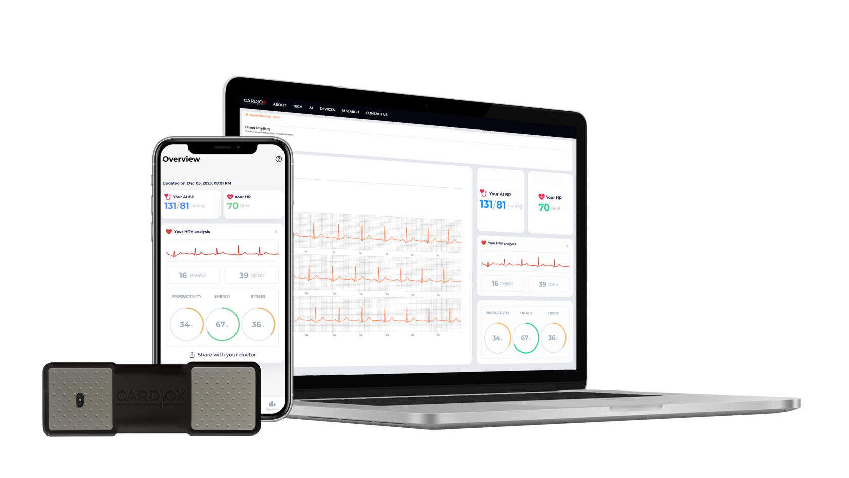 CardioX — Transforming Health Monitoring