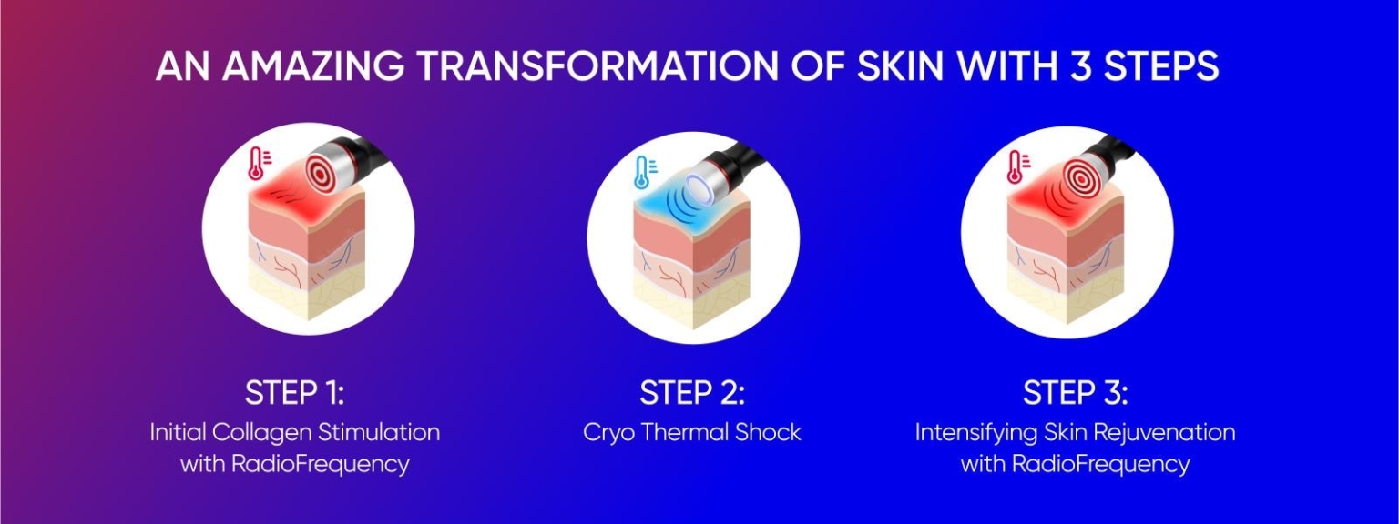 Zemits FrioLift CRYO RF Contrast Skin Rejuvenation System | Esthetic ...