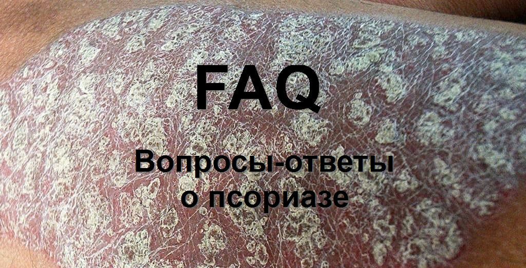FAQ о псориазе, вопросы и ответы
