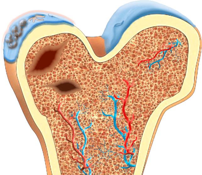 ОСТЕОМЕД ФОРТЕ - ОСТЕОПРОТЕКТОР НОВОГО ПОКОЛЕНИЯ