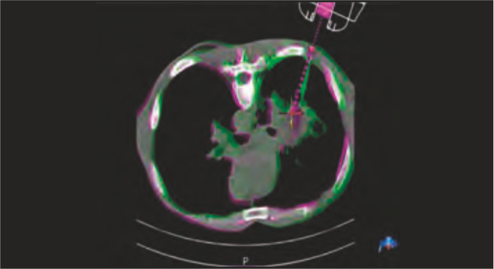 Perfint™ Maxio® | Россия