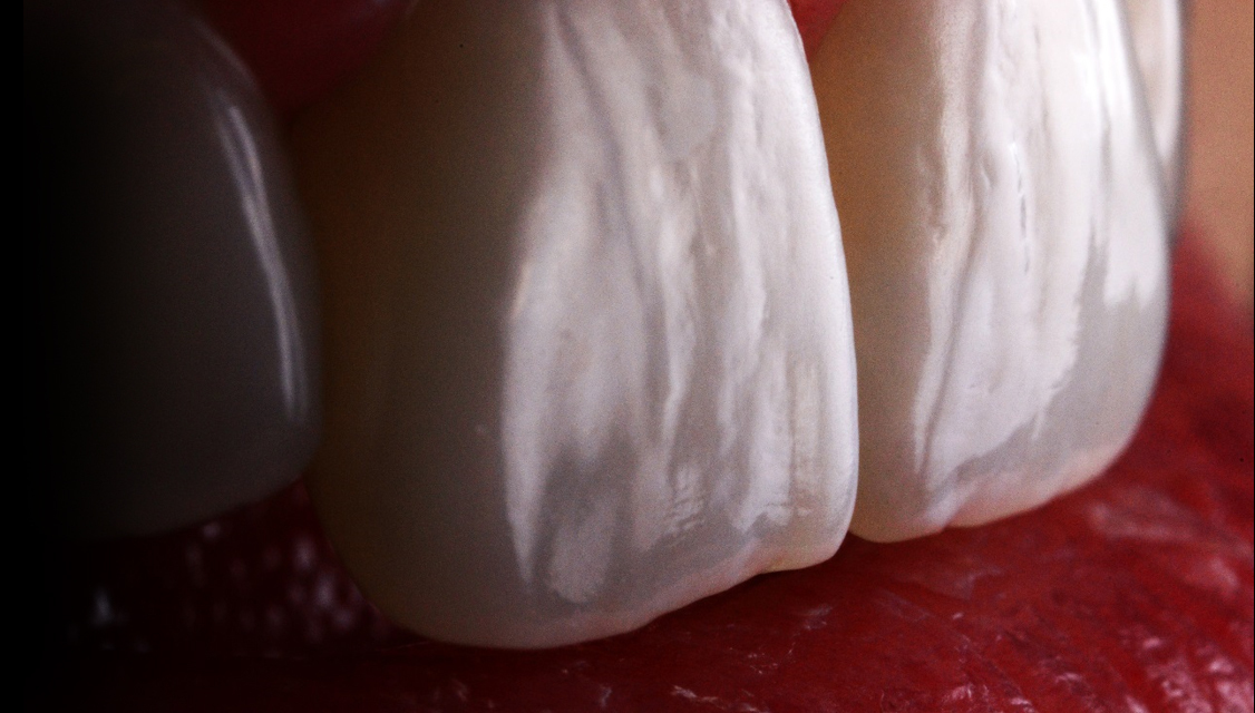 Pascal Magne: February 25, 2022