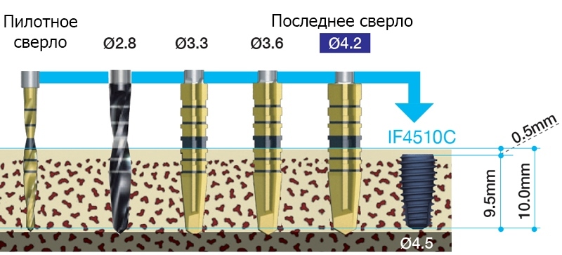 Хирургический протокол