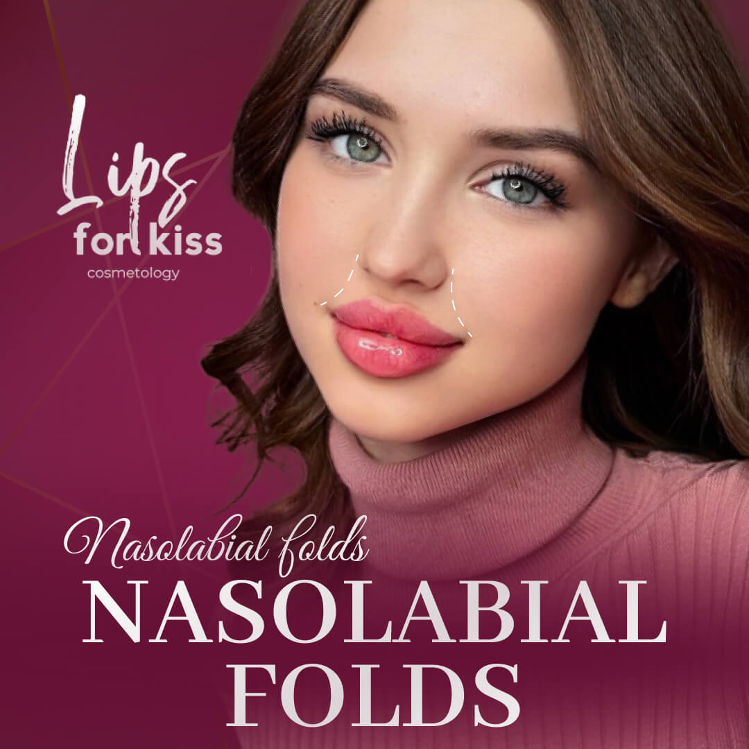 NASOLABIAL FOLDS