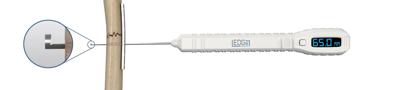 Edge Surgical: Introducing The First And Only Single-Use Electronic ...