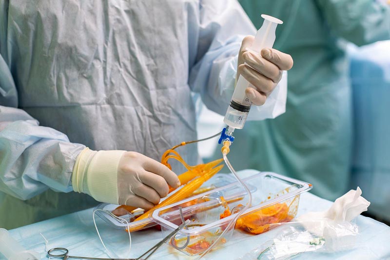 Подготовка фаллопротеза Coloplast Titan Touch для имплантации