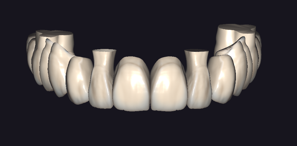 Exocad - Программа для стоматологов
