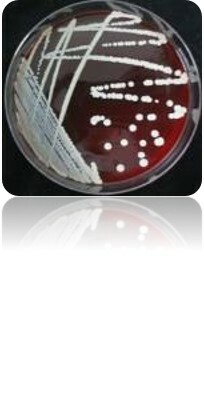 Автоматический анализатор антибиотикочувствительности AutoMic- i600 от ...