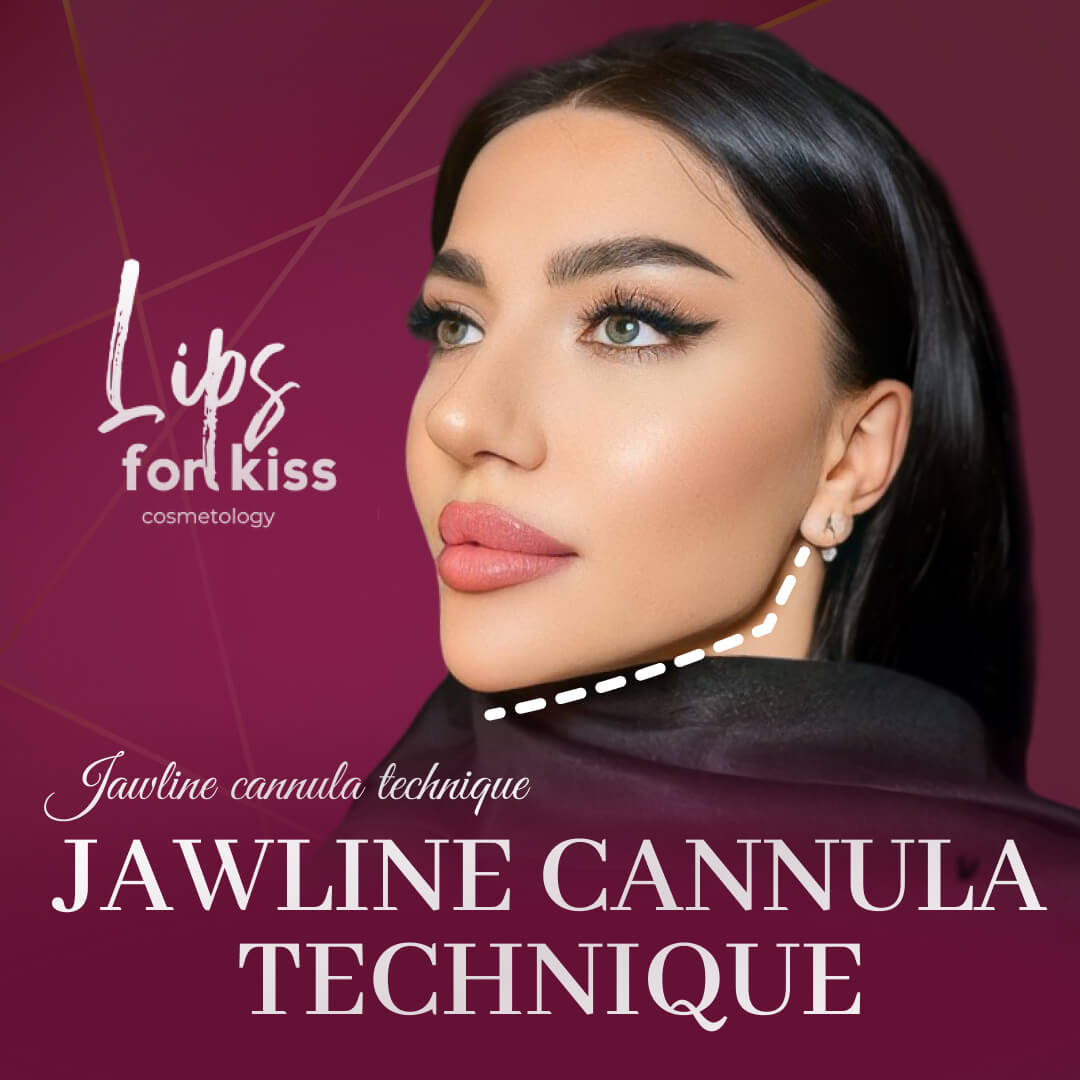 JAWLINE CANNULA TECHNIQUE