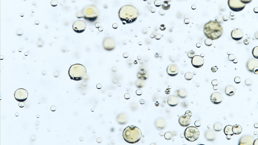 Lipid-based formulations