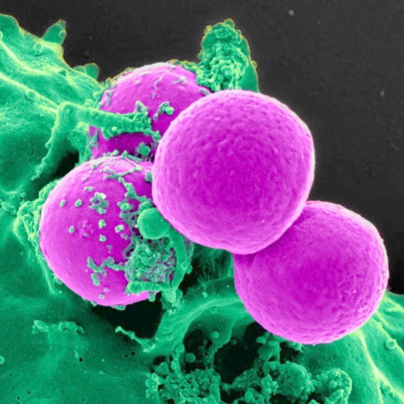METABIOTIC FRS Комплексная пищевая добавка. Купить METABIOTIC FRS.