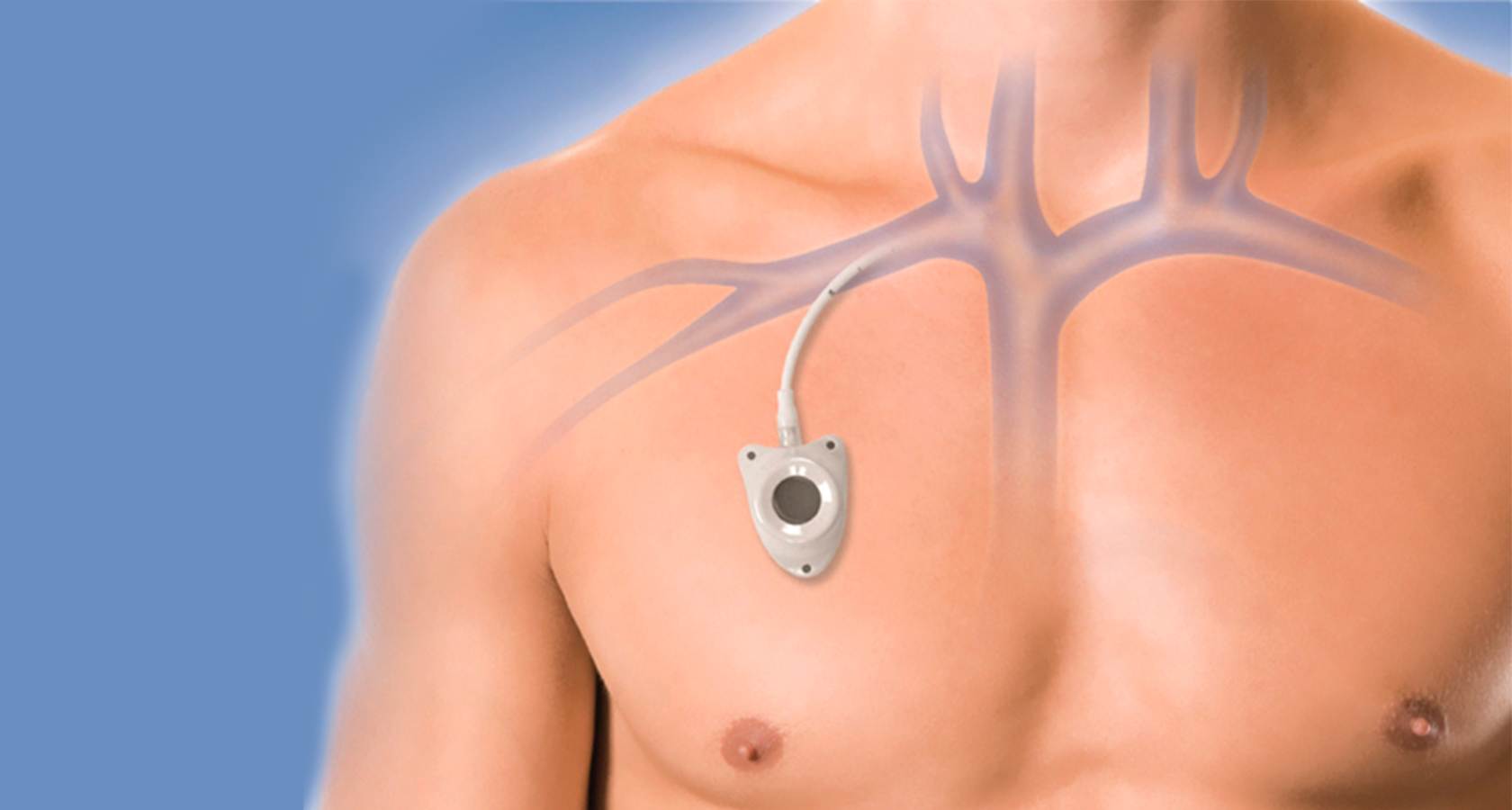 Порт-система Celsite: виды, преимущества и советы по выбору