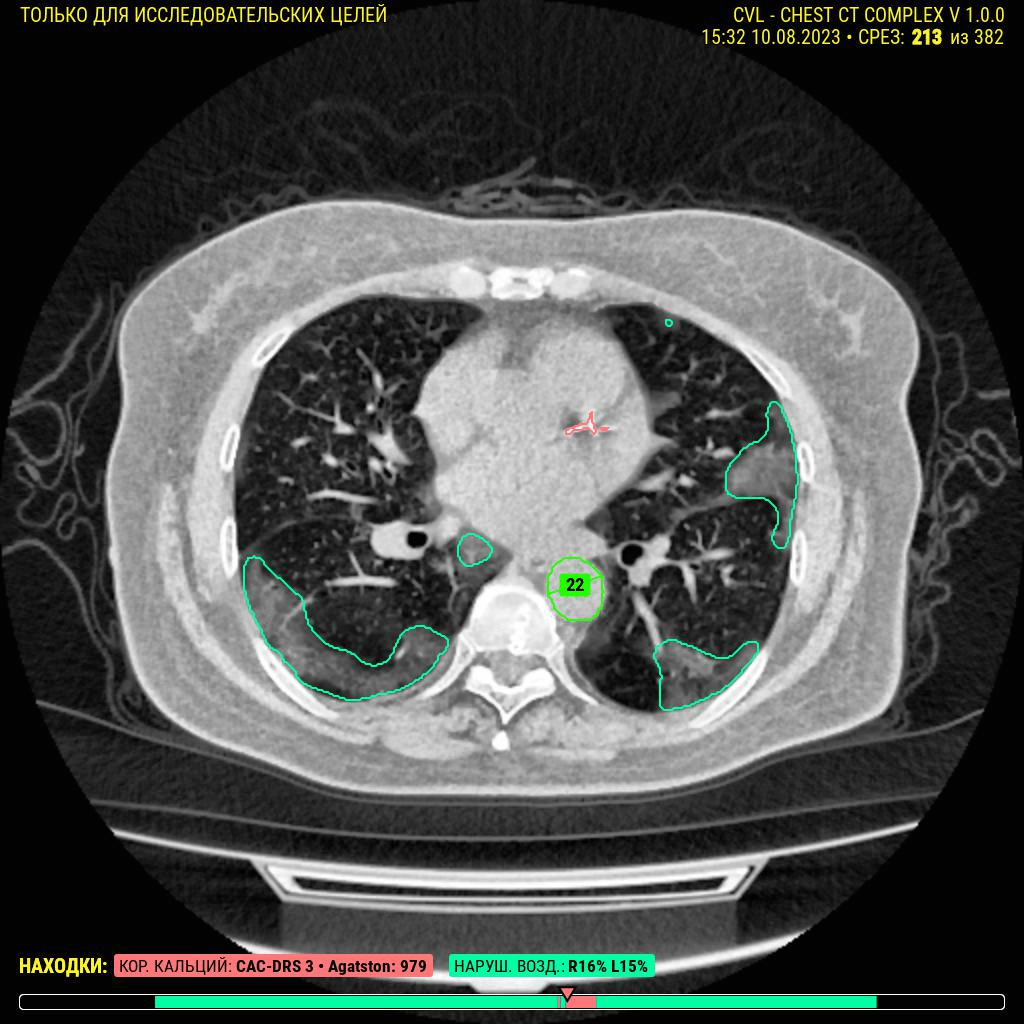 CVisionRad — облачный сервис на основе искусственного интеллекта
