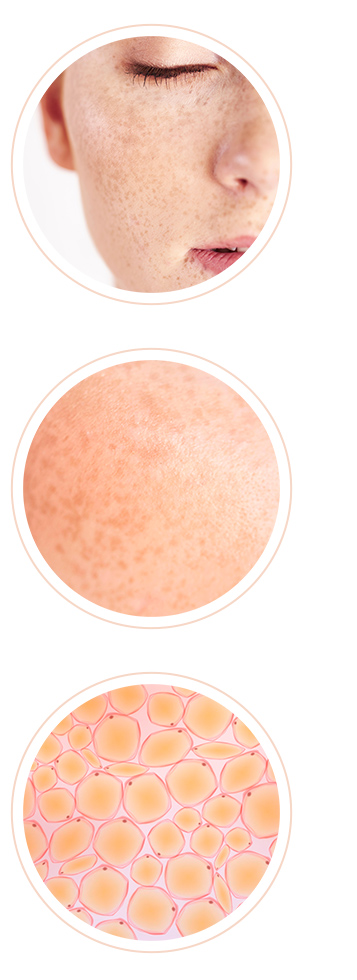 Haut.AI – Machine Vision & Artificial Intelligence – AI for Skincare ...