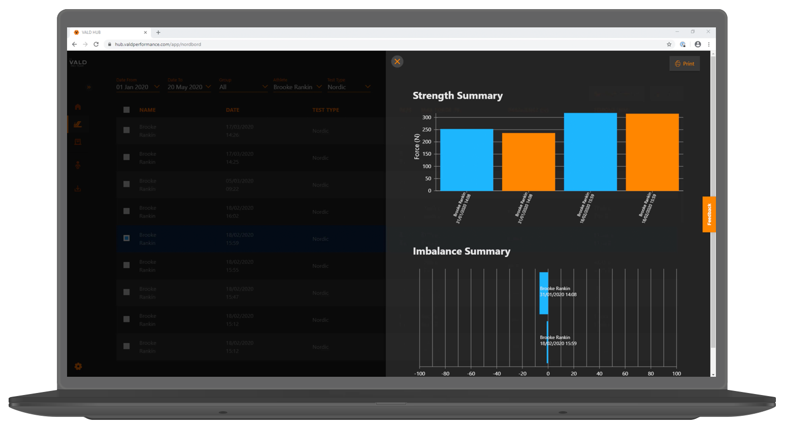 NordBord | Система тестирования подколенного сухожилия
