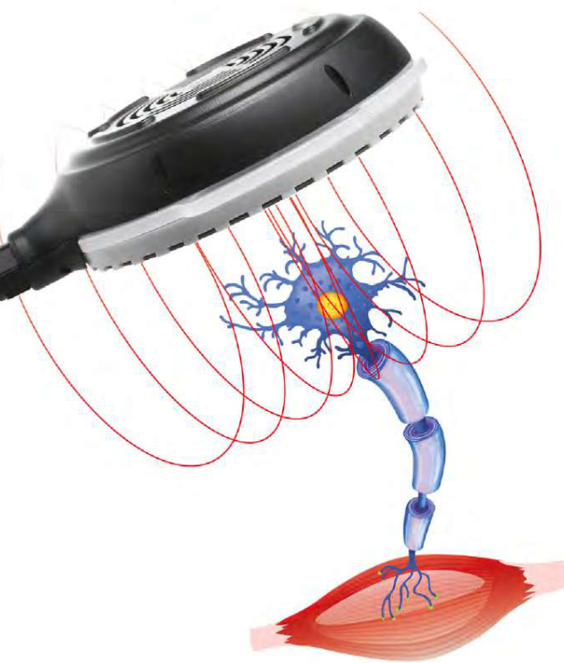 TESLA FORMER - уникальная методика коррекции фигуры