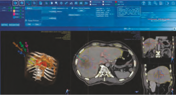 Perfint™ Maxio® | Россия